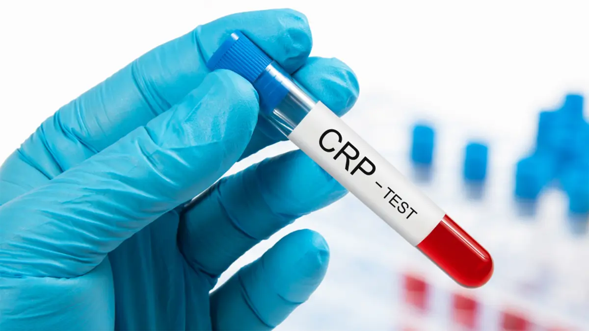 C‑Reactive Protein and its Role in Heart Disease | Clarity UPSC